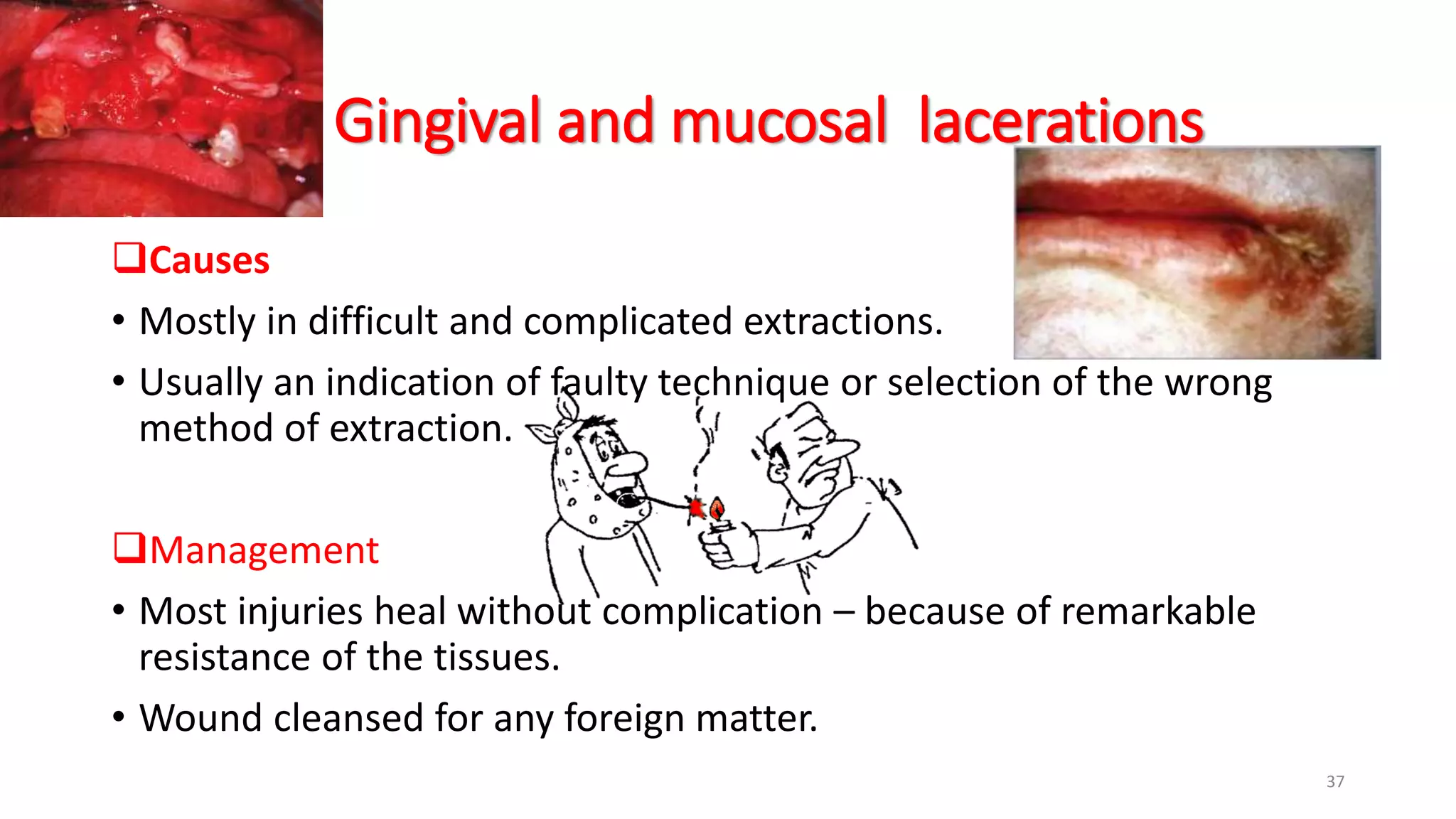Complication of extraction | PPTX