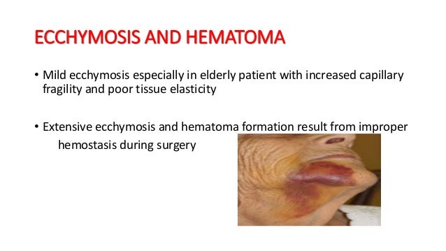 Complication of extraction