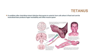 Complication Of Fracture | PPTX
