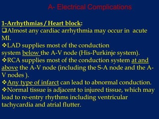 Complication of MI.pptx