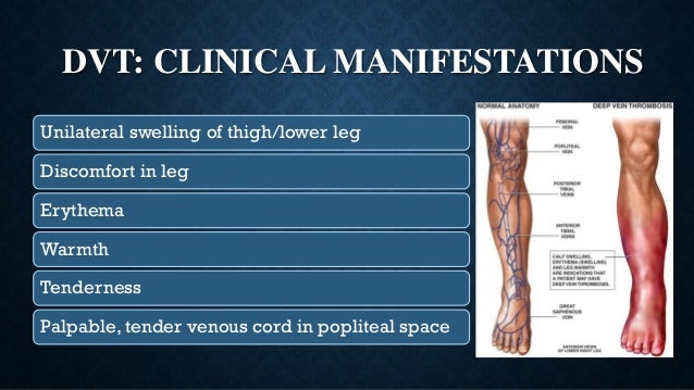 Complication of traumatology theme lecture