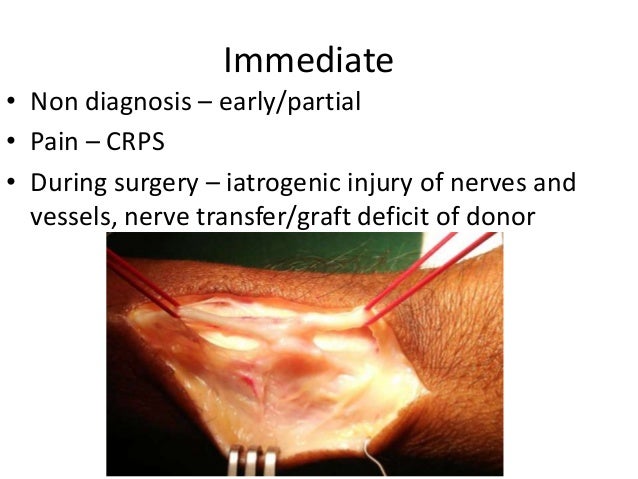Complications in nerve surgery