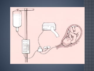 complications-during-labor-and-birth.pptx
