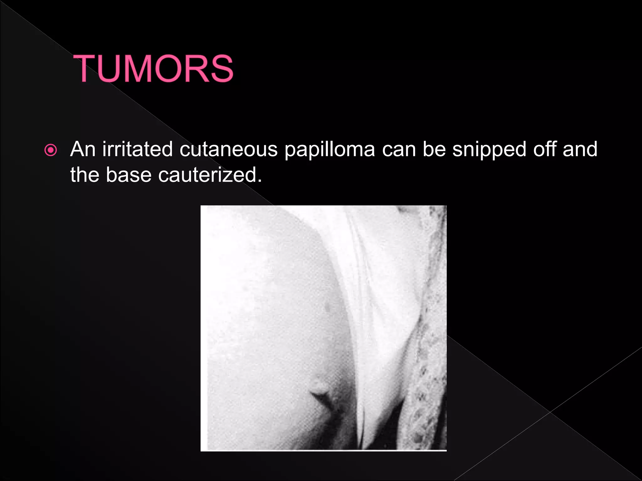 Complications After Amputation Pptx