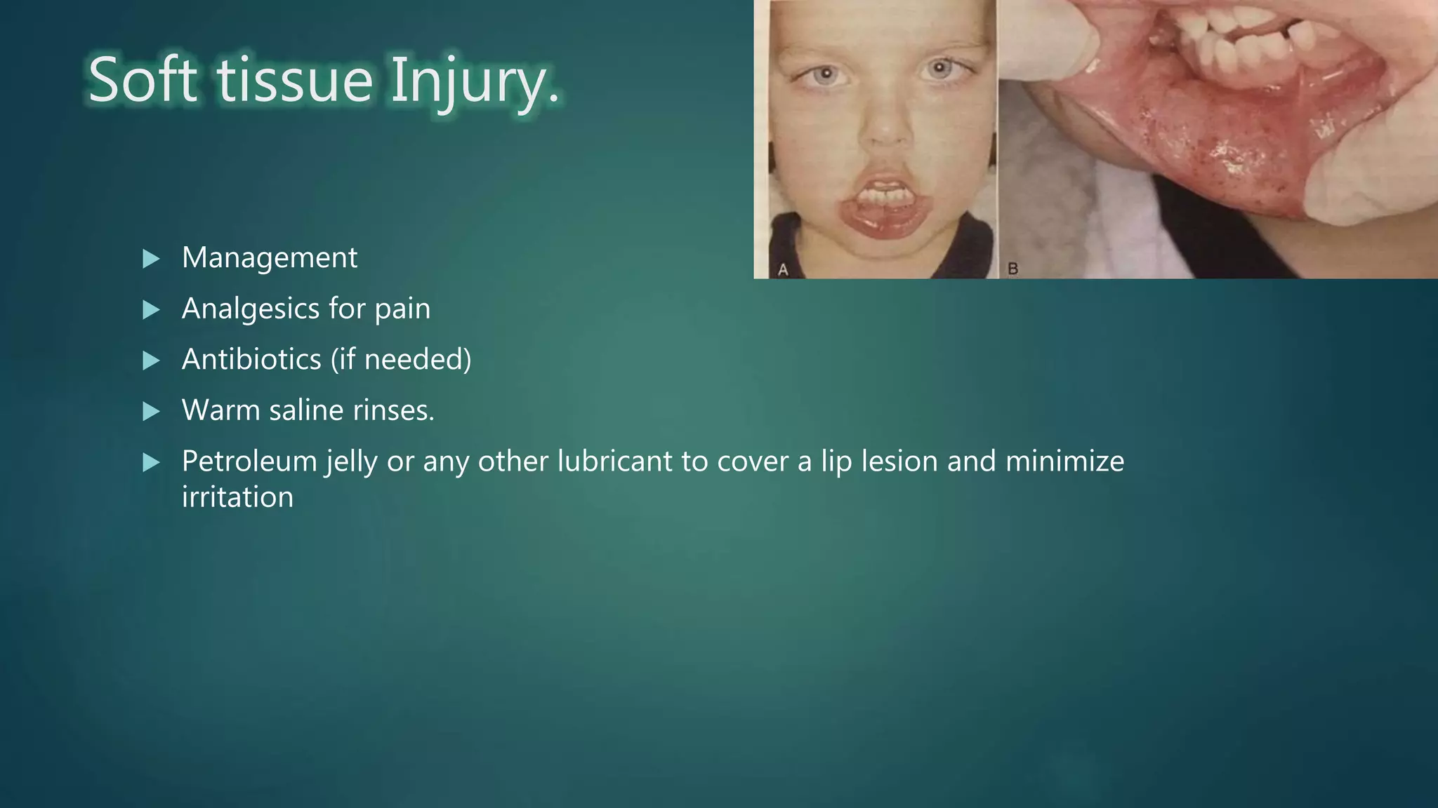 Complications and management of local anesthesia | PPTX