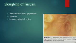 Complications and management of local anesthesia | PPTX