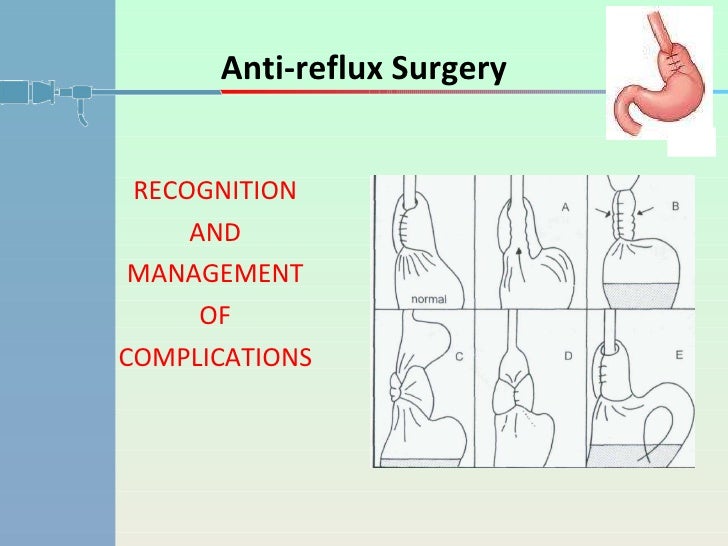 Complications Following Antireflux Surgery: Recognition and Management