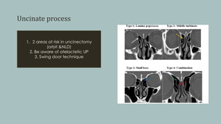 Complications in endoscopic sinus surgery | PPTX