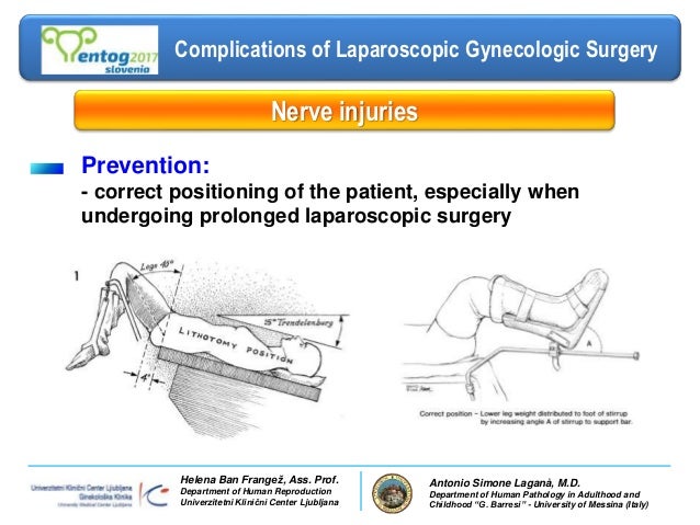 Complications of Laparoscopic Gynecologic Surgery
