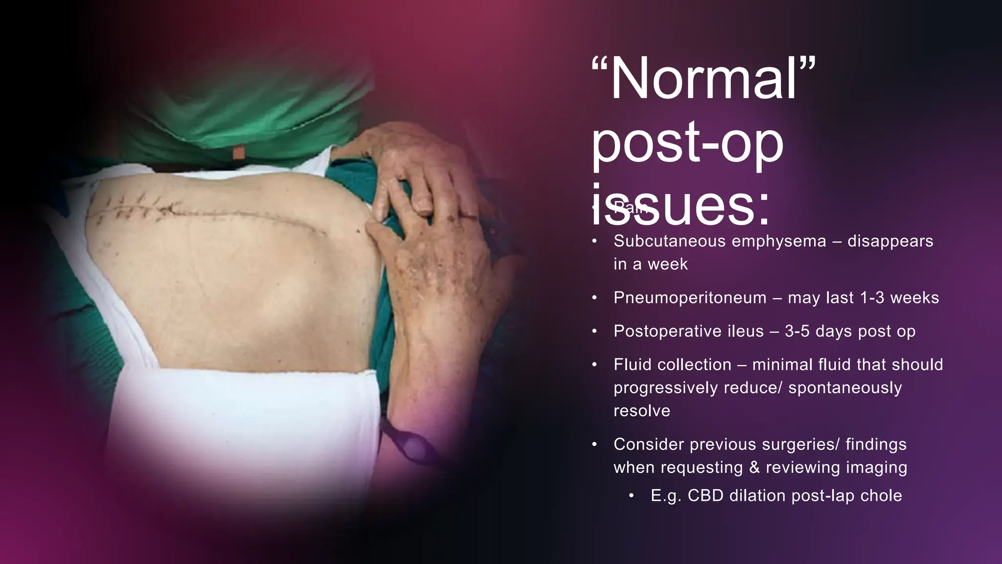 Complications of abdominal surgery power point | PPTX