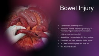 Complications of abdominal surgery power point | PPTX