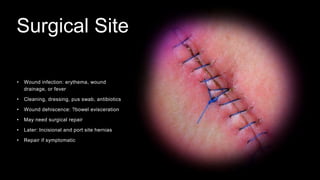 Complications of abdominal surgery power point | PPTX