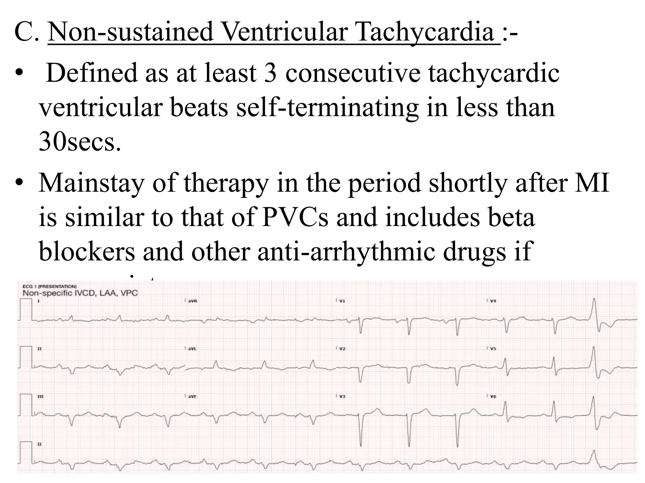 COMPLICATIONS OF ACUTE CORONARY SYNDROME AND ITS MANAGEMENT.pptx
