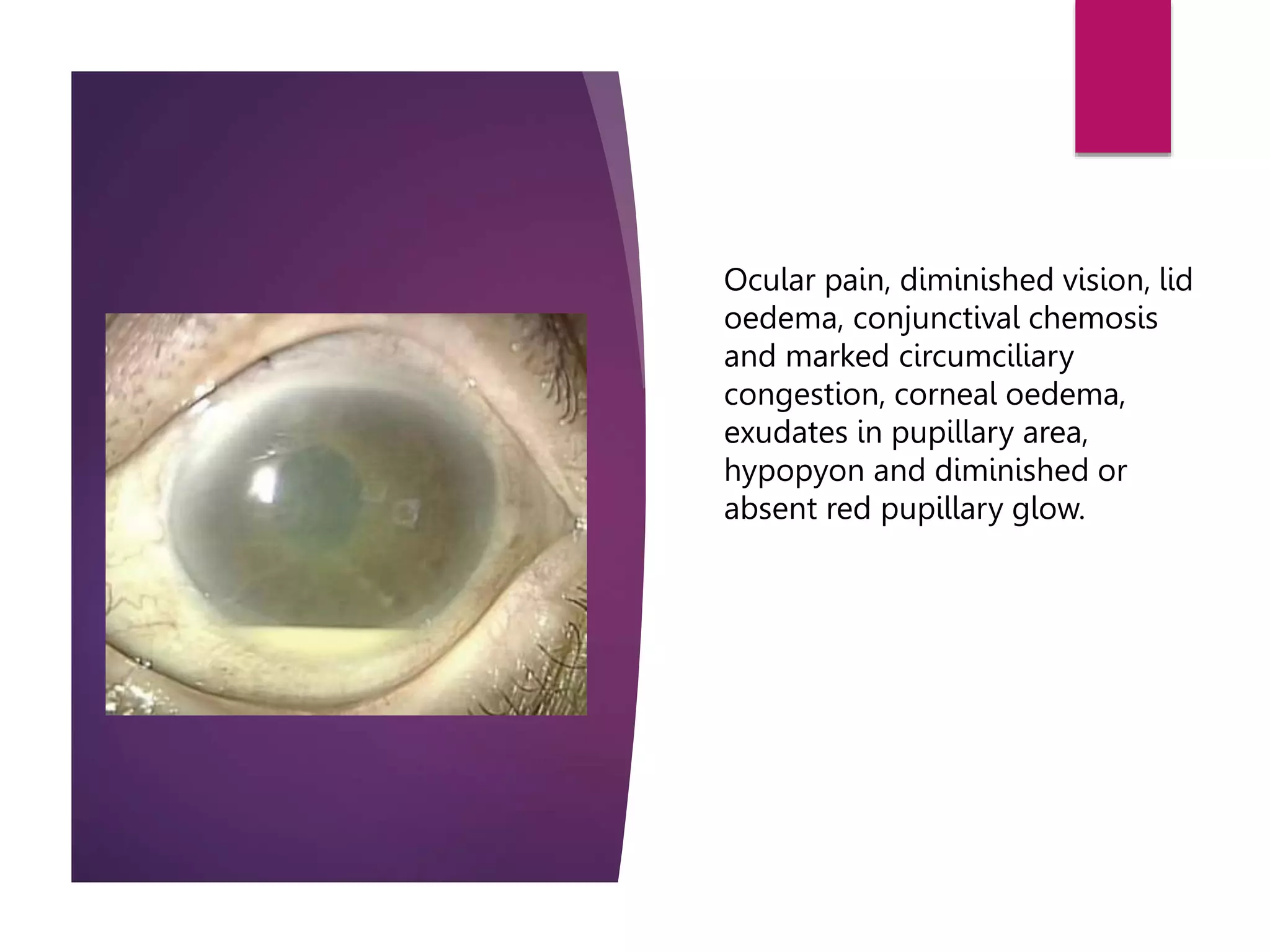 COMPLICATIONS OF CATARACT.pptx