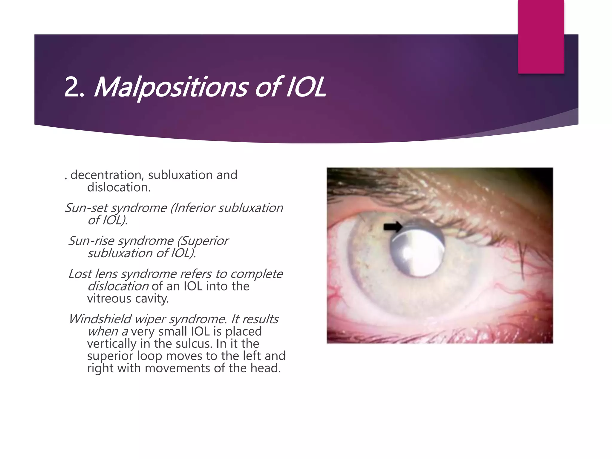 COMPLICATIONS OF CATARACT.pptx