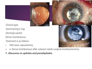 COMPLICATIONS OF CATARACT.pptx
