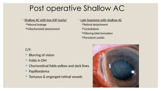 Complications of cataract.pptx important | PPTX