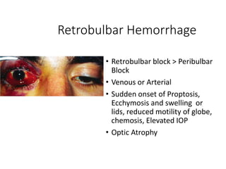 Complications of Cataract surgery 2 .pptx