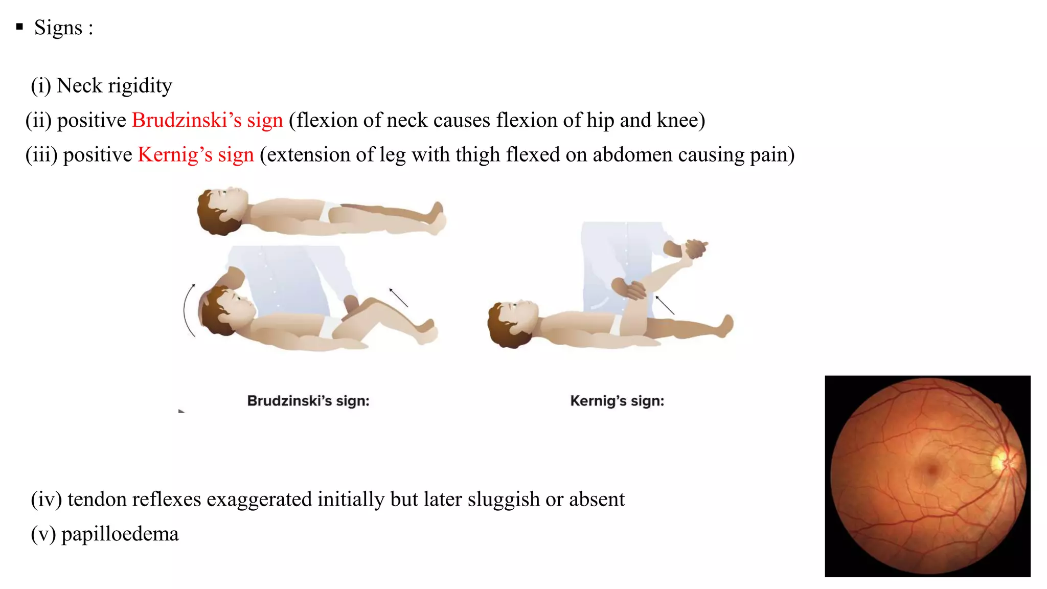 Complications of Chronic Otitis Media.pptx