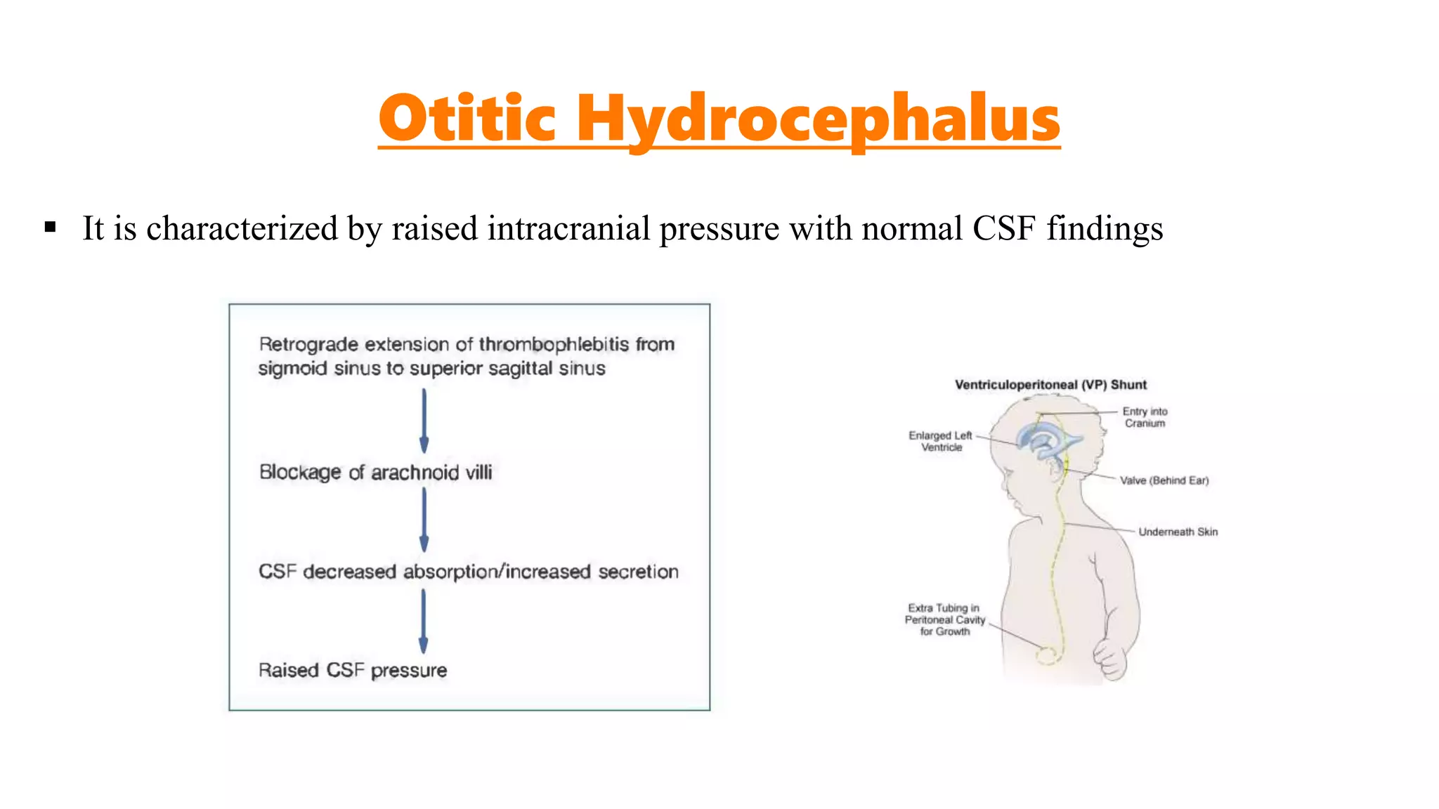 Complications of Chronic Otitis Media.pptx