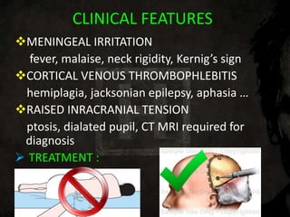 Complications of csom | PPTX