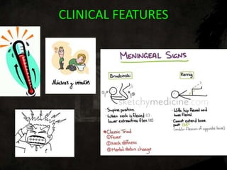 Complications of csom | PPTX