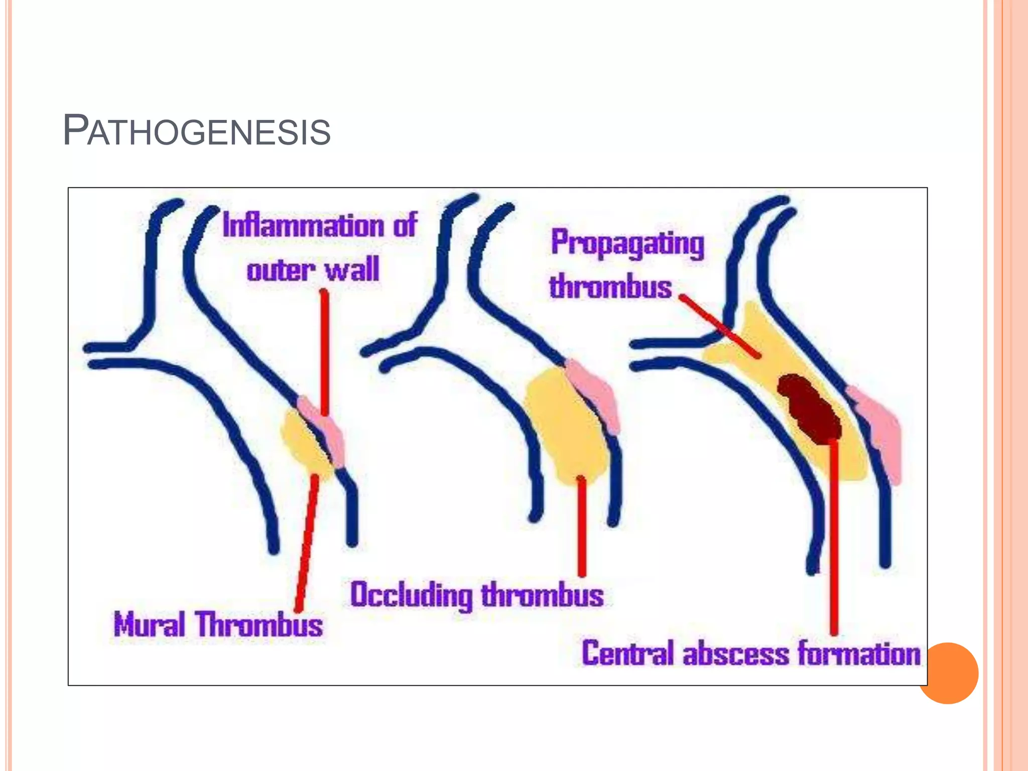 Complications of csom | PPTX