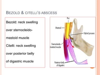 Complications of csom | PPTX