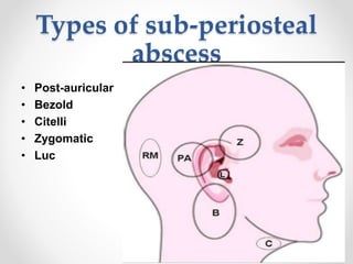 Complications of csom | PPT