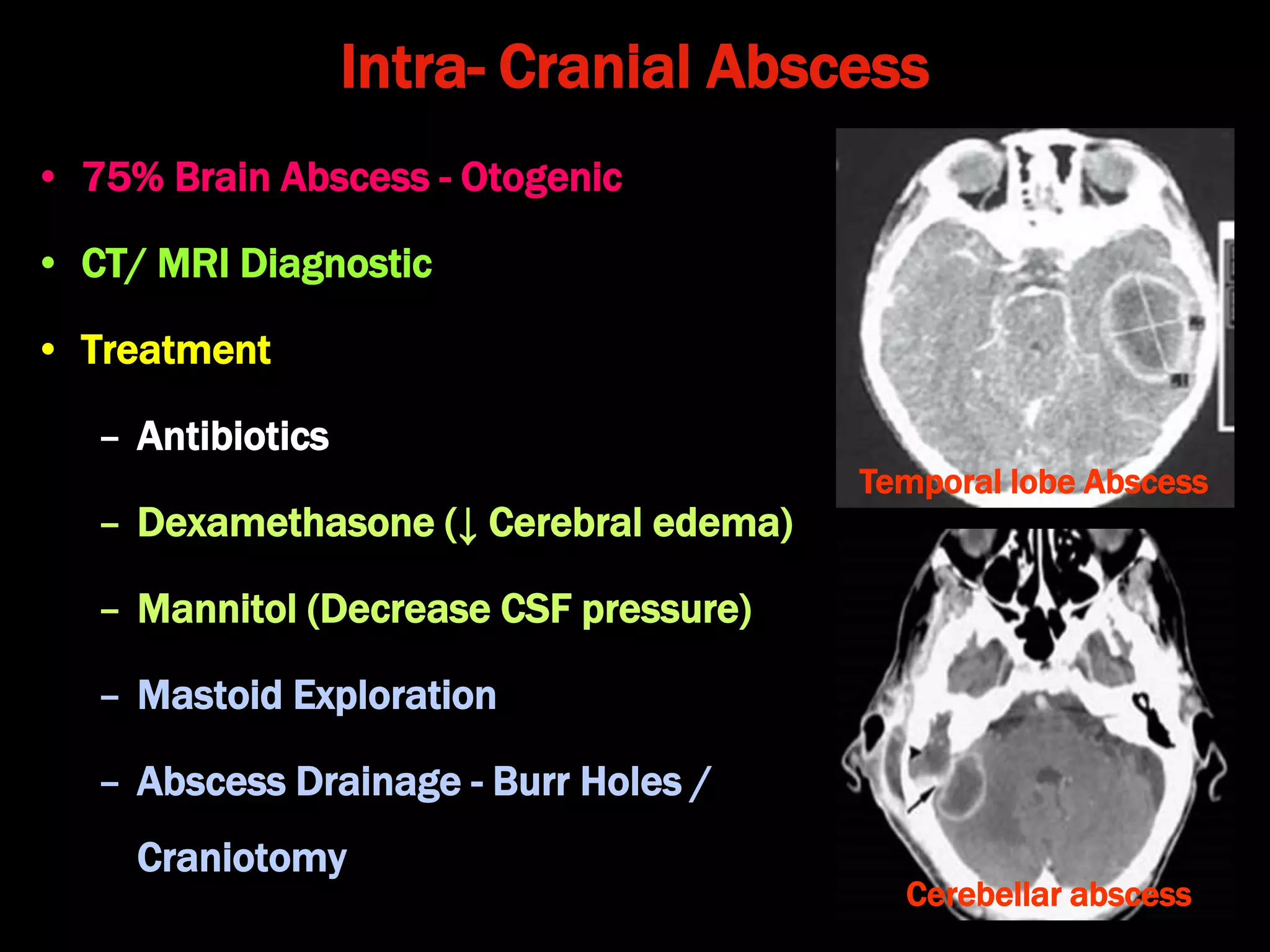 Complications of csom | PPT | Ear, Nose and Throat Conditions ...