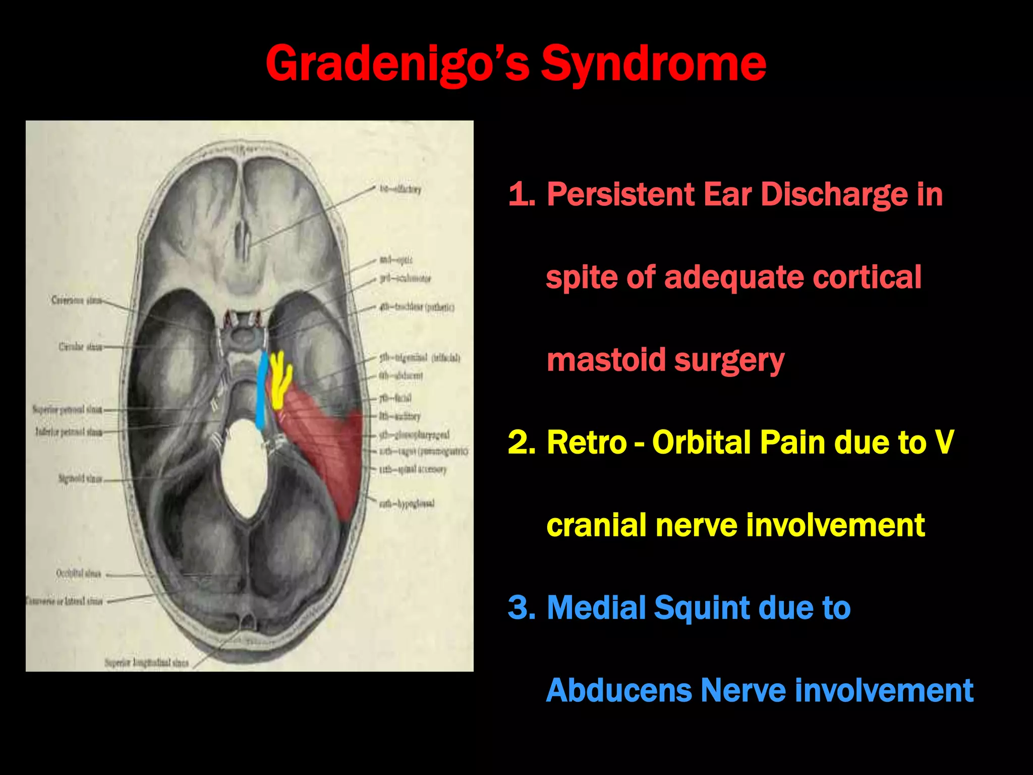 Complications of csom | PPT