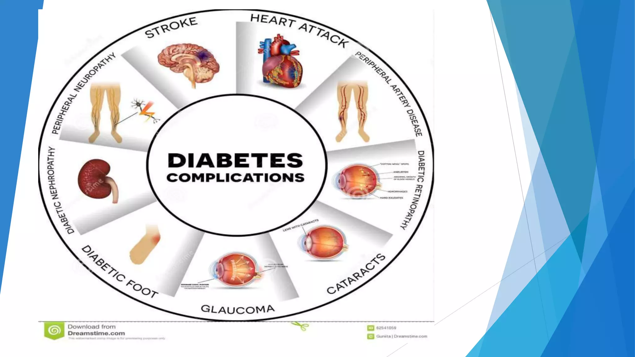 Complications of diabetes mellitus | PPTX