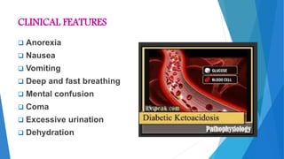 Complications of diabetes mellitus | PPTX