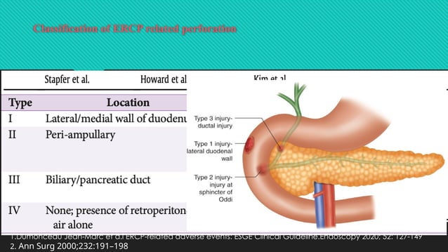 post ERCP pancreatitis.indications, cotraindications,types of ...