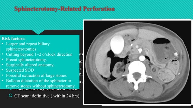 post ERCP pancreatitis.indications, cotraindications,types of ...
