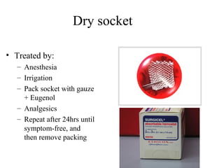 Dry Socket Packing