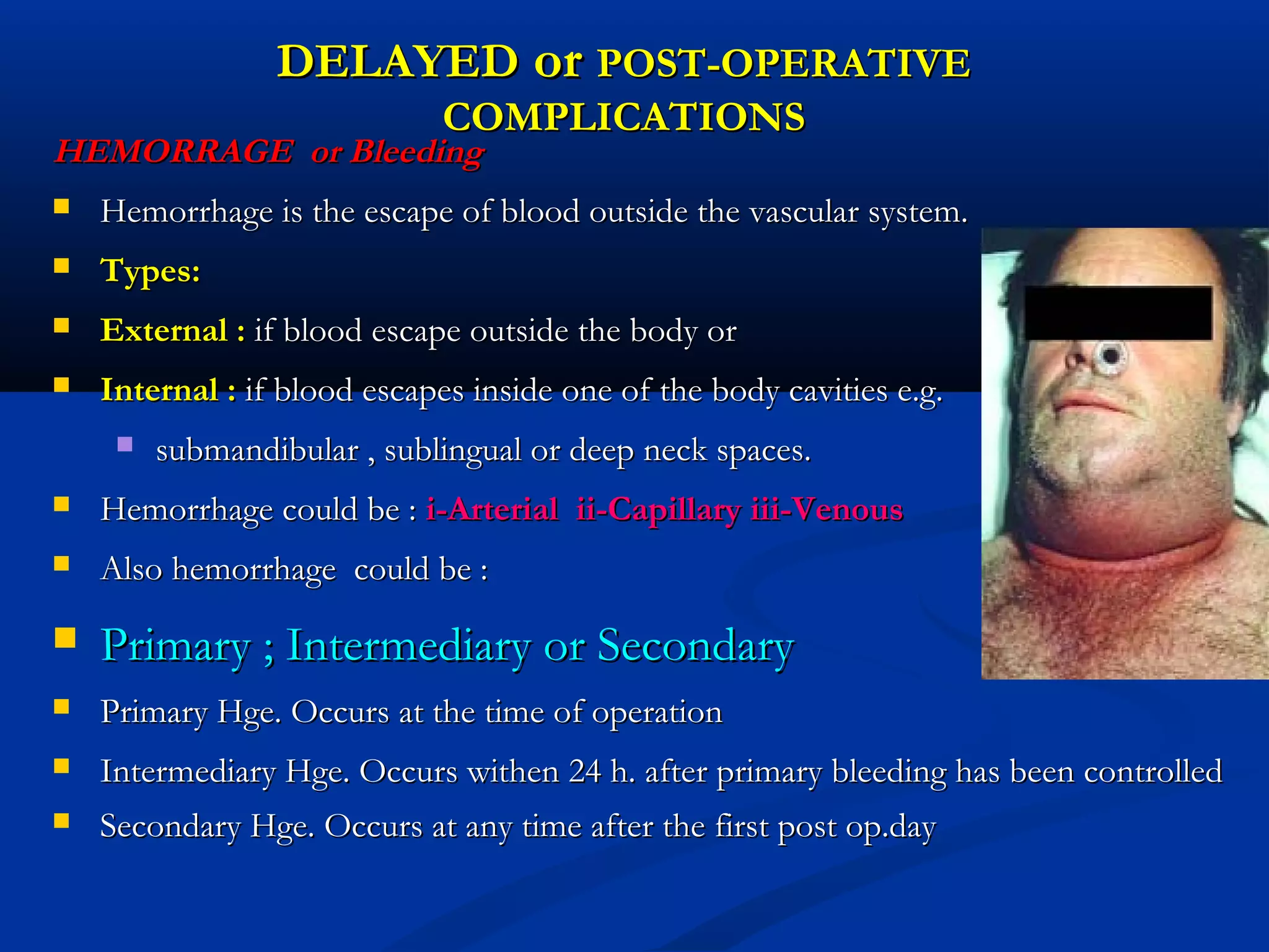 Complications of Exodontia | PPT