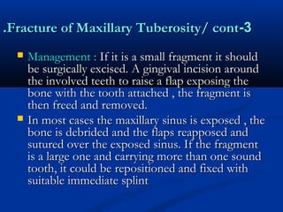 Maxillary Tuberosity Fracture