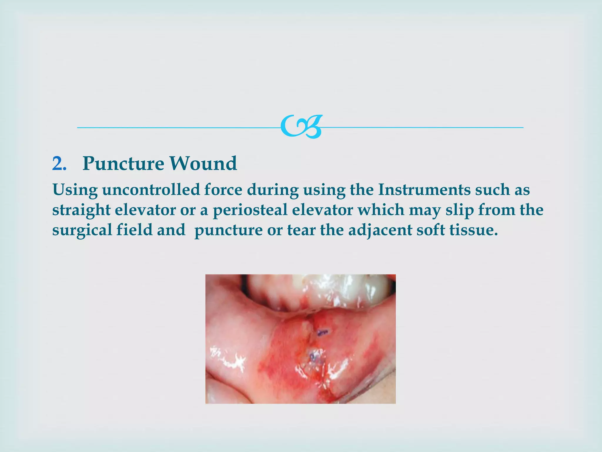 Complications of Extraction | PPTX