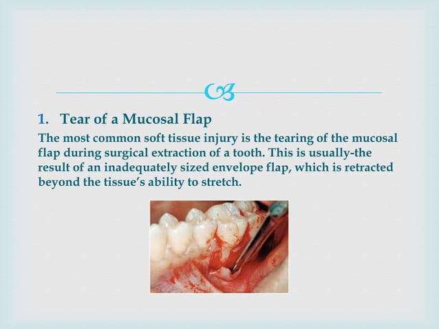 Complications of Extraction | PPTX | Death, Injury, or Military ...