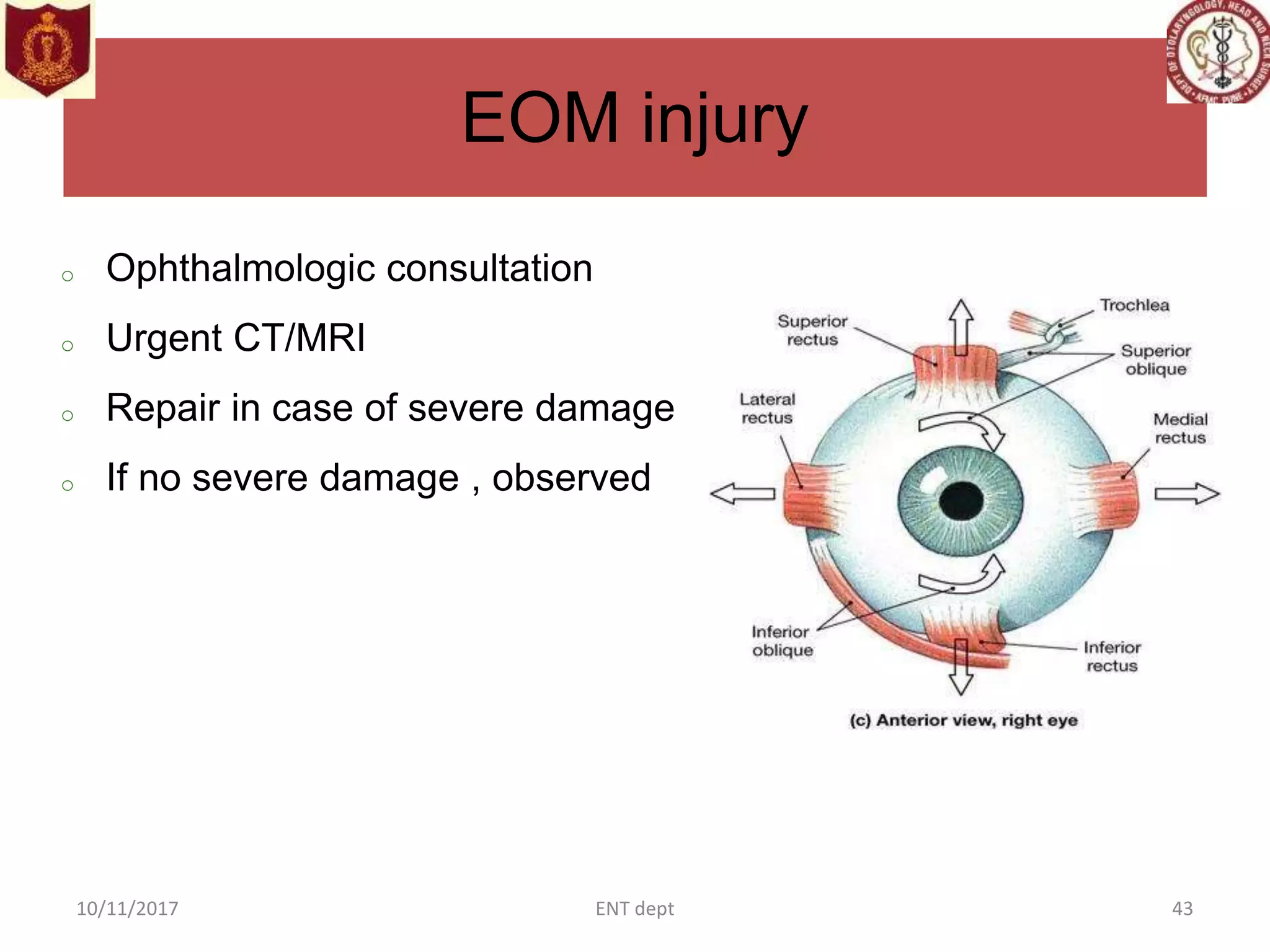 Complications of fess | PPTX