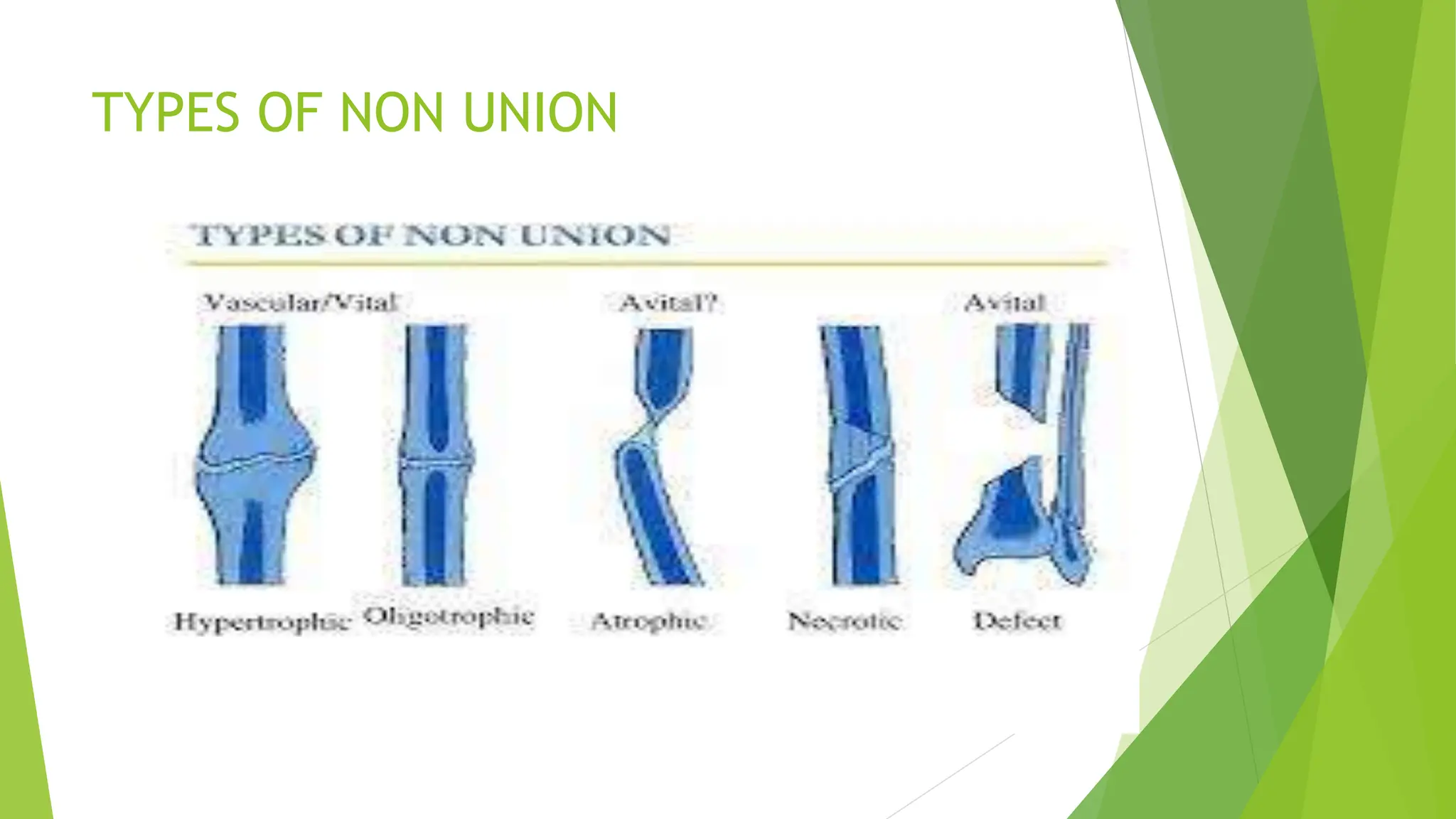 Complications of orthopedic fracture.pptx