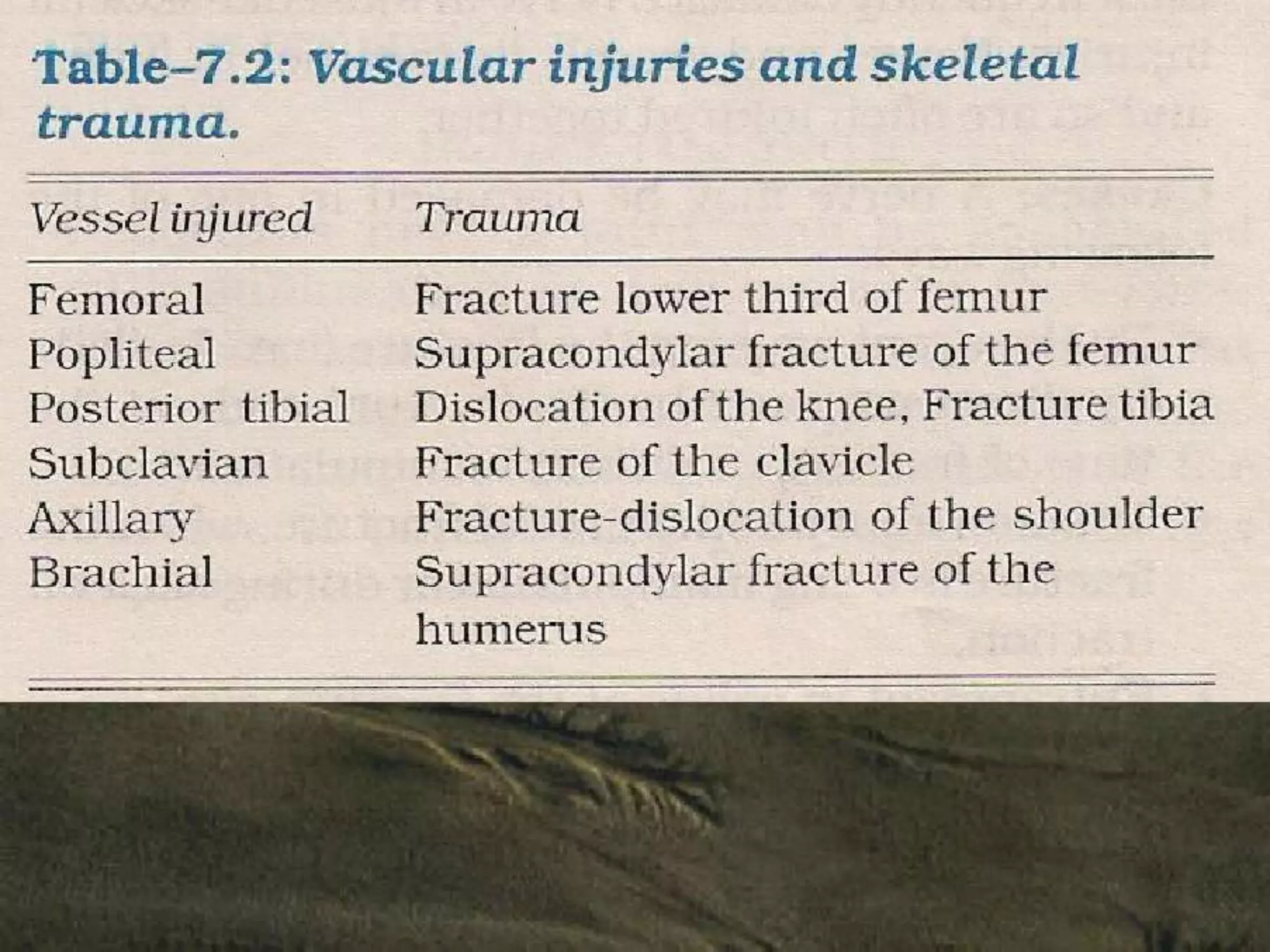 Complications of fractures | PPTX