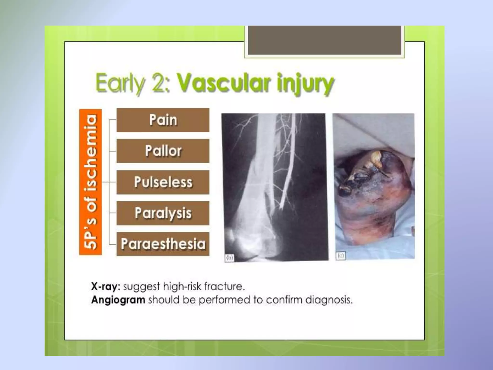 Complications of fractures of bones | PPT