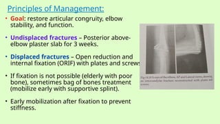 COMPLICATIONS OF FRACTUREShhhhhhhh (1).pptx