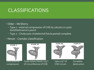 Complications of gall stones with all treatments.pptx