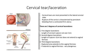 Complications of labor | PPTX