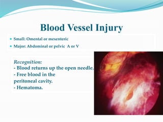 Complications of Laparoscopy (1) 2.pdf