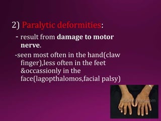 COMPLICATIONS OF LEPROSY & ITS MANAGEMENT | PPTX