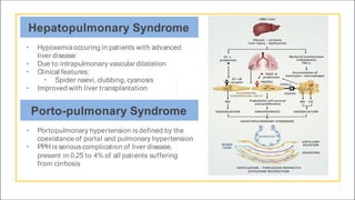 Complications of liver cirrhosis .pdf